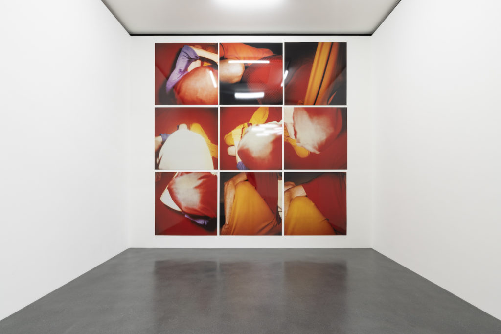 Hannah Villiger "Amaze Me" Muzeum Susch | | Flash Art